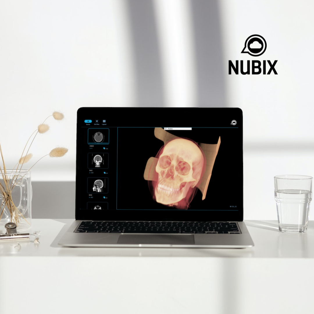 NUBIX updates